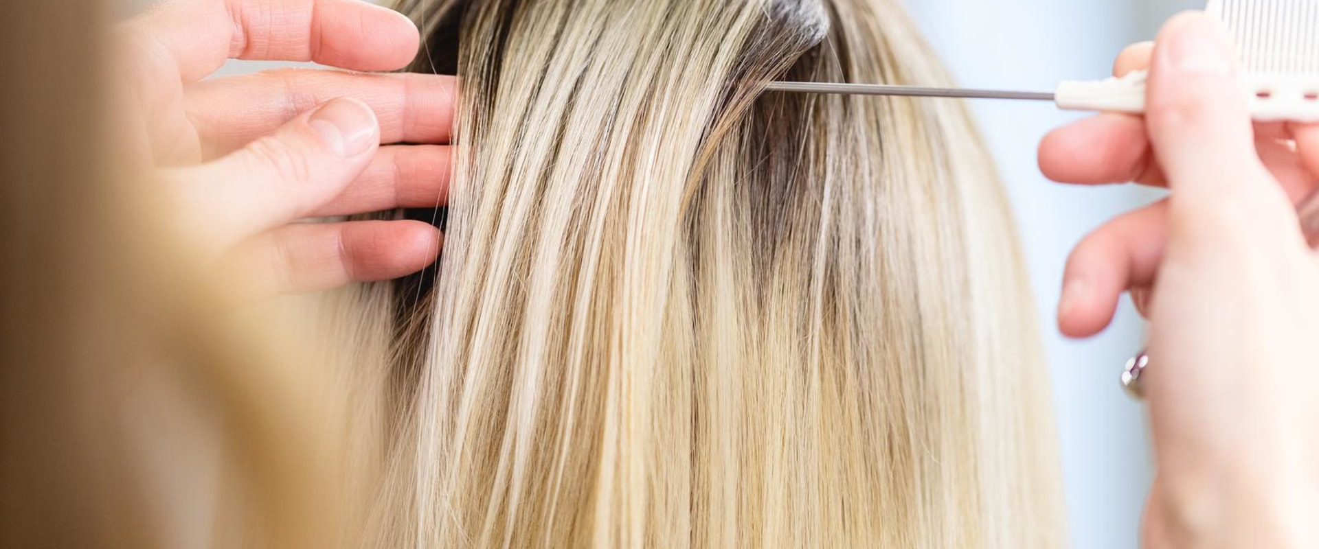 Hair Transplantation: The Ideal Solution For Hair Loss Following Laser ...